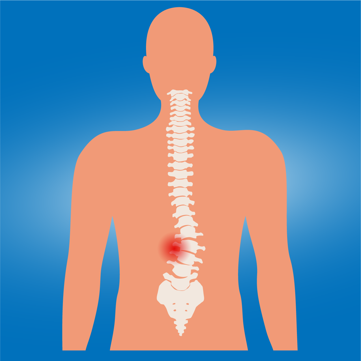 Escoliose - Dr. Vanderlei Sartor